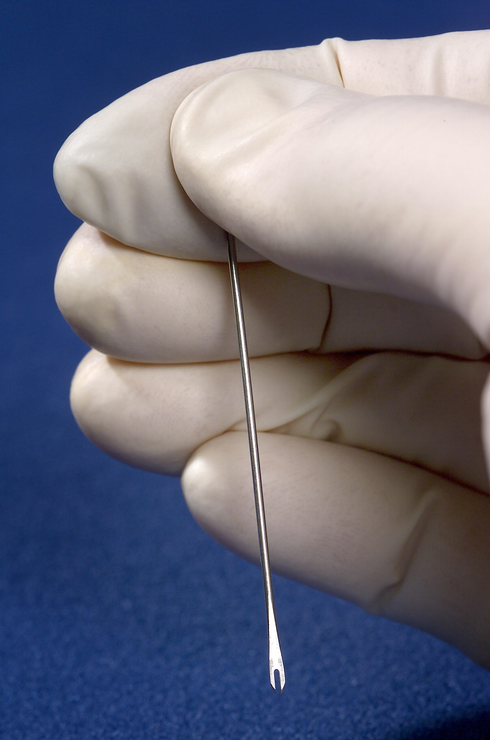 Varíola: a única doença humana erradicada no planeta - Invivo